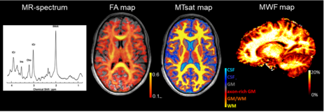 Pediatric Multimodal Neuroimaging